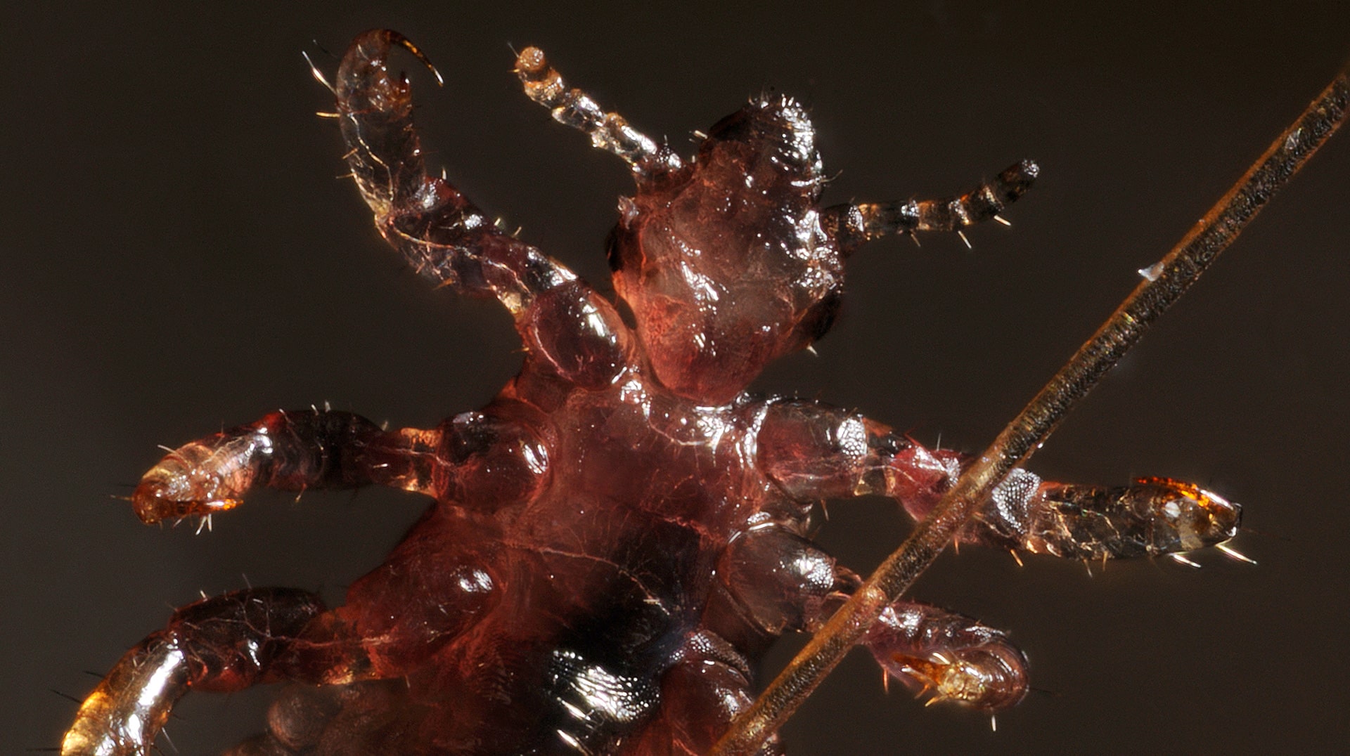 Jajeczka wszy, czyli gnidy. Jak je rozpoznać? Jak się ich pozbyć ...